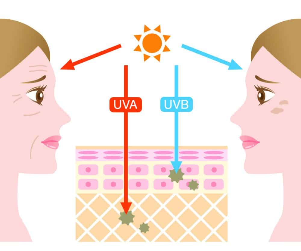 3 Face Procedures to Improve Skin from Sun Exposure in Miami